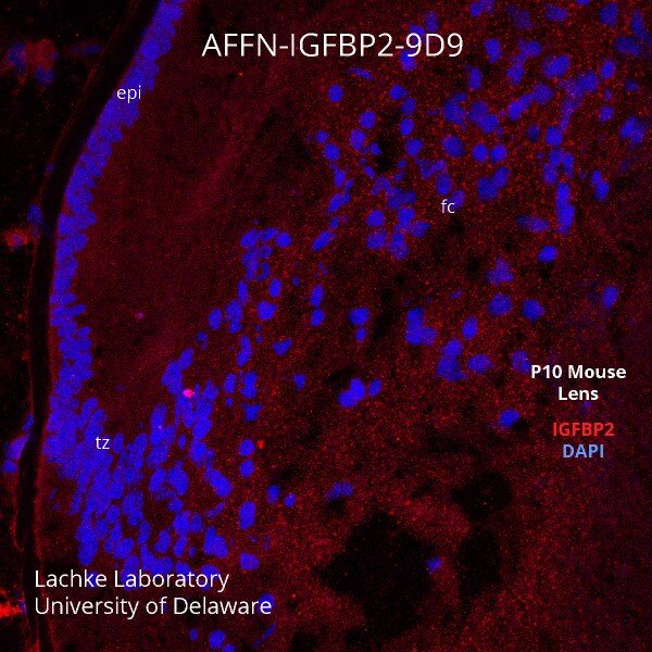 IGFBP2 Antibody (AFFN-IGFBP2-9D9) - DSHB