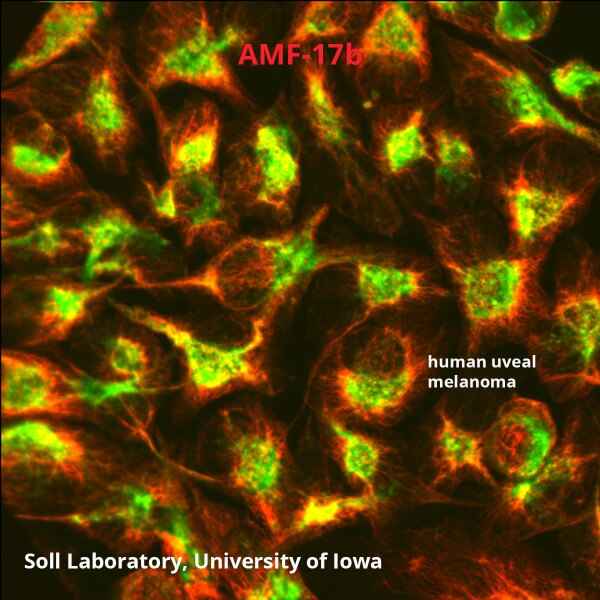 VIM Antibody (AMF-17b) - DSHB