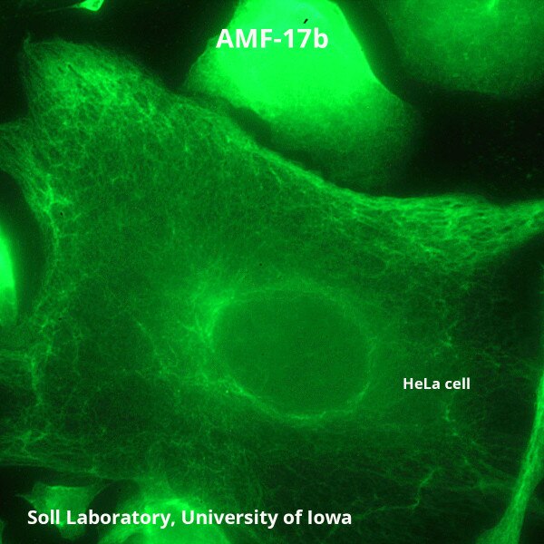 VIM Antibody (AMF-17b) - DSHB