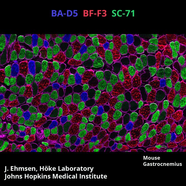 Myosin heavy chain type I Antibody (BA-D5) - DSHB