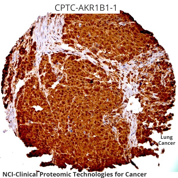 AKR1B1 Antibody (CPTC-AKR1B1-1) - DSHB