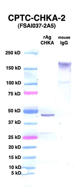 Choline kinase alpha Antibody (CPTC-CHKA-2) - DSHB