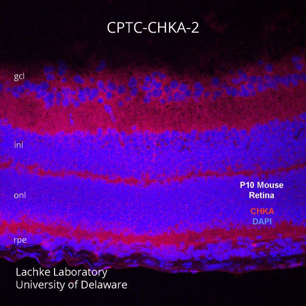 Choline kinase alpha Antibody (CPTC-CHKA-2) - DSHB