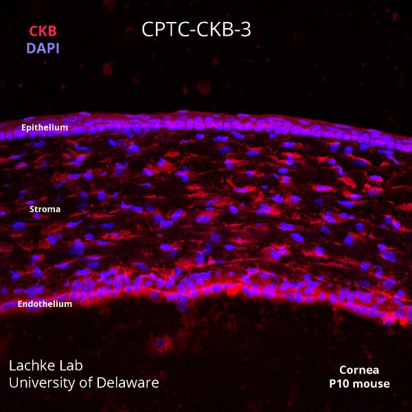 Creatine kinase B chain Antibody (CPTC-CKB-3) - DSHB