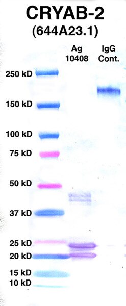 CRYAB -crystallin alpha B Antibody (CPTC-CRYAB-2) - DSHB