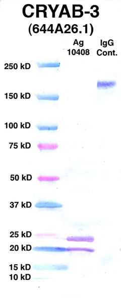 CRYAB -crystallin alpha B Antibody (CPTC-CRYAB-3) - DSHB