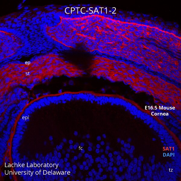 SAT1 Antibody (CPTC-SAT1-2) - DSHB