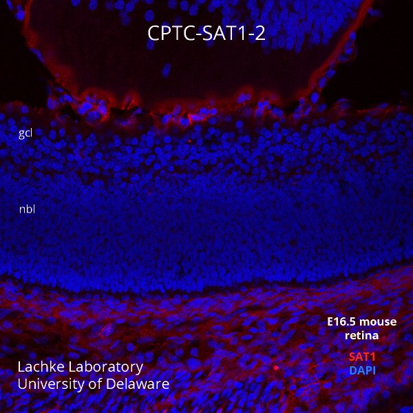 SAT1 Antibody (CPTC-SAT1-2) - DSHB