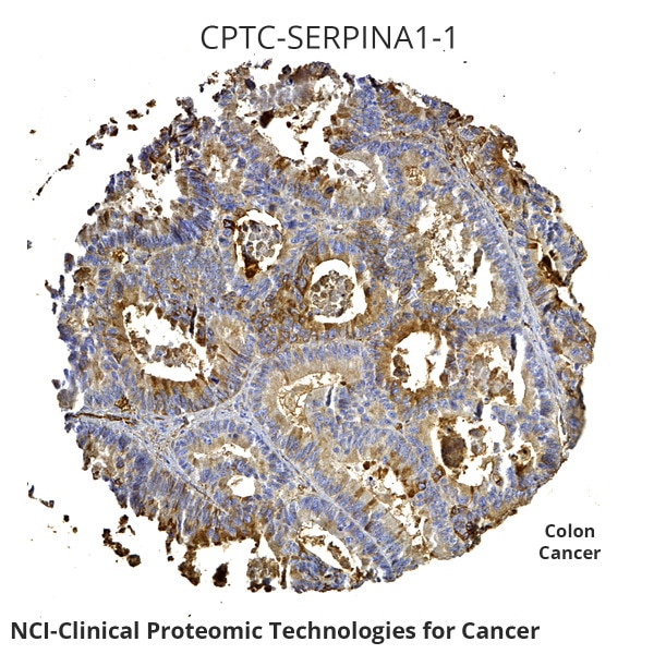 SERPINA1 Antibody (CPTC-SERPINA1-1) - DSHB