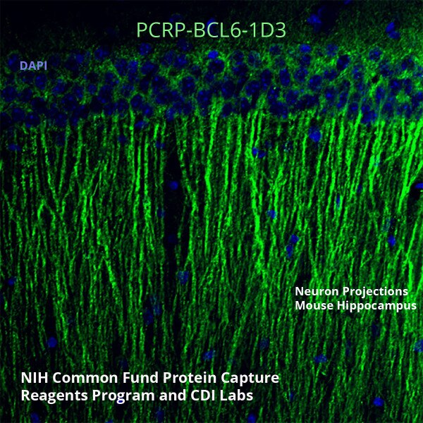BCL6 Antibody (PCRP-BCL6-1D3) - DSHB