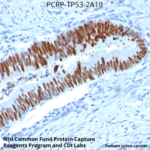 TP53 Antibody (PCRP-TP53-2A10) - DSHB
