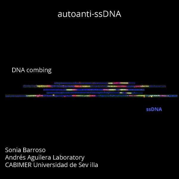 Autoimmune ssDNA Antibody (autoanti-ssDNA) - DSHB