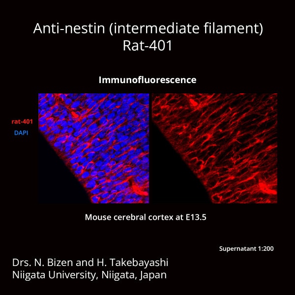 Nes Antibody (rat-401) - DSHB